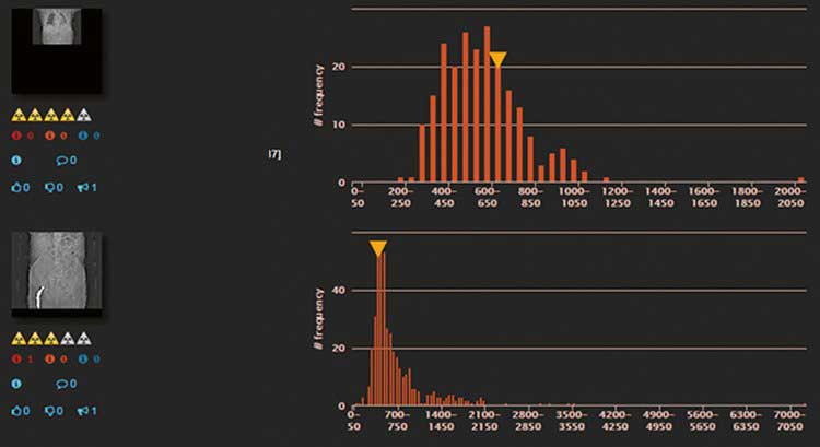 Why should you invest in dose management systems? - MiNNOVAA