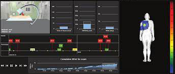 What is Dose Management Software? - MiNNOVAA