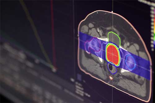 Why is important to calculate radiation dose? - MiNNOVAA