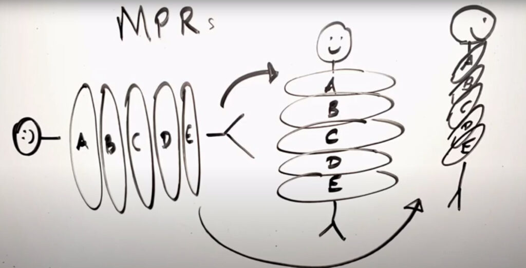 CT Image Reconstruction - MiNNOVAA