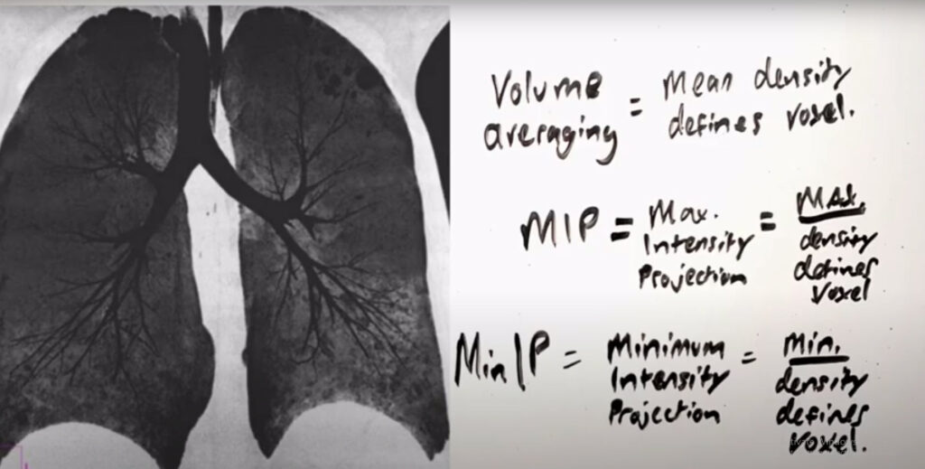 CT Image Reconstruction - MiNNOVAA