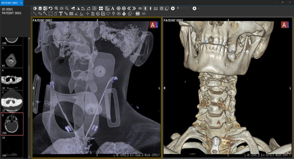 XEUS Imaging Workstation - MiNNOVAA