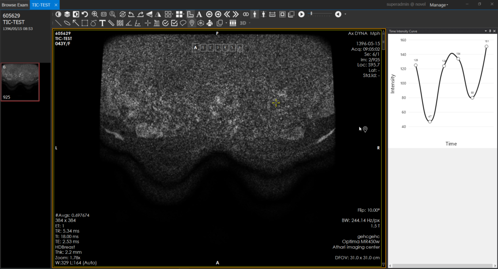 XEUS Imaging Workstation - MiNNOVAA