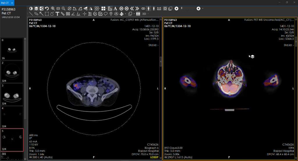 XEUS Imaging Workstation - MiNNOVAA