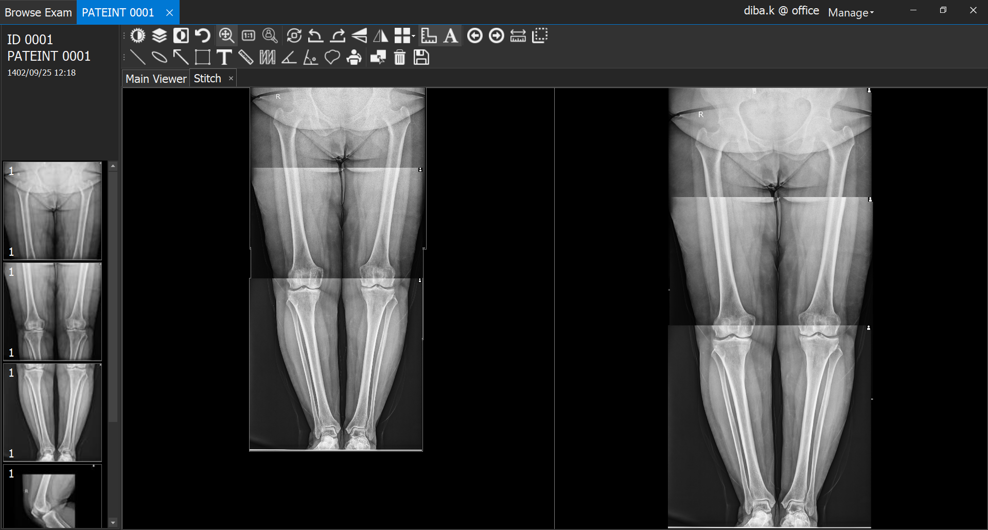 XEUS Imaging Workstation - MiNNOVAA