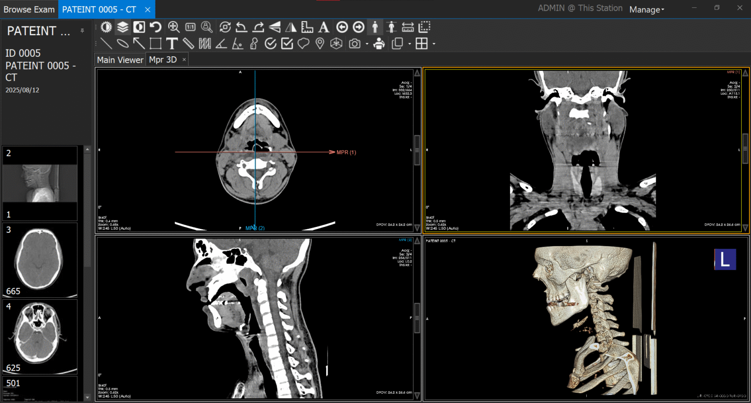 MPR/MIP in XEUS: Technical Guide for Clinical Imaging